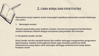 ppt kb implant kb susuk yang ditanam di bawah kulit | PPTX