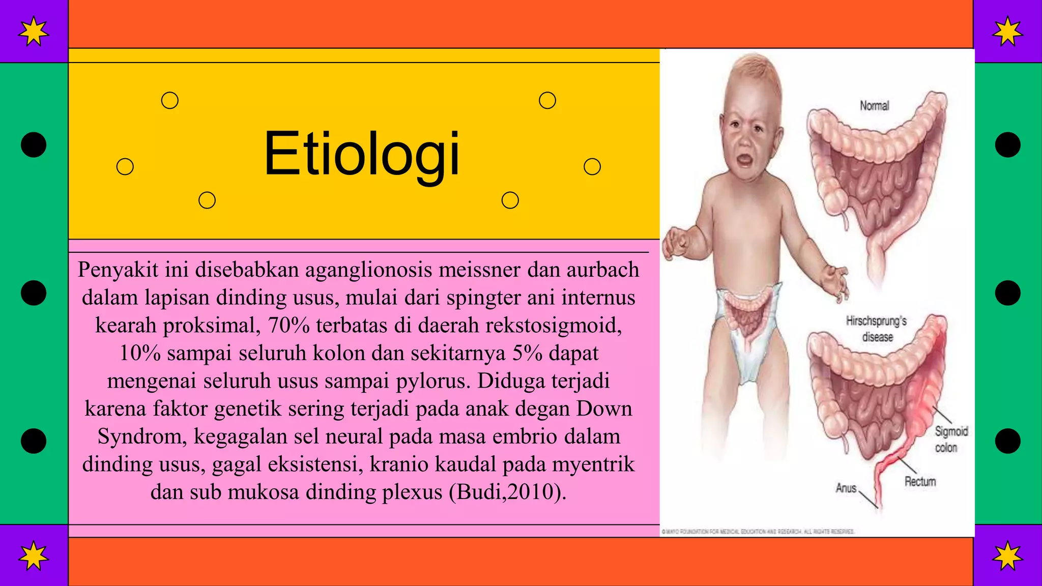 PPT KEL.4 HIRSCHPRUNGS.pptx