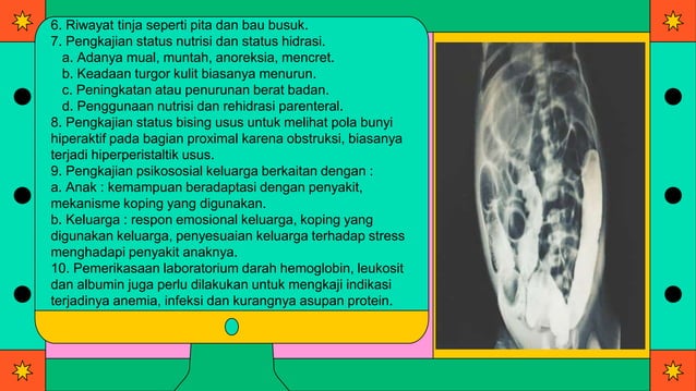 PPT KEL.4 HIRSCHPRUNGS.pptx