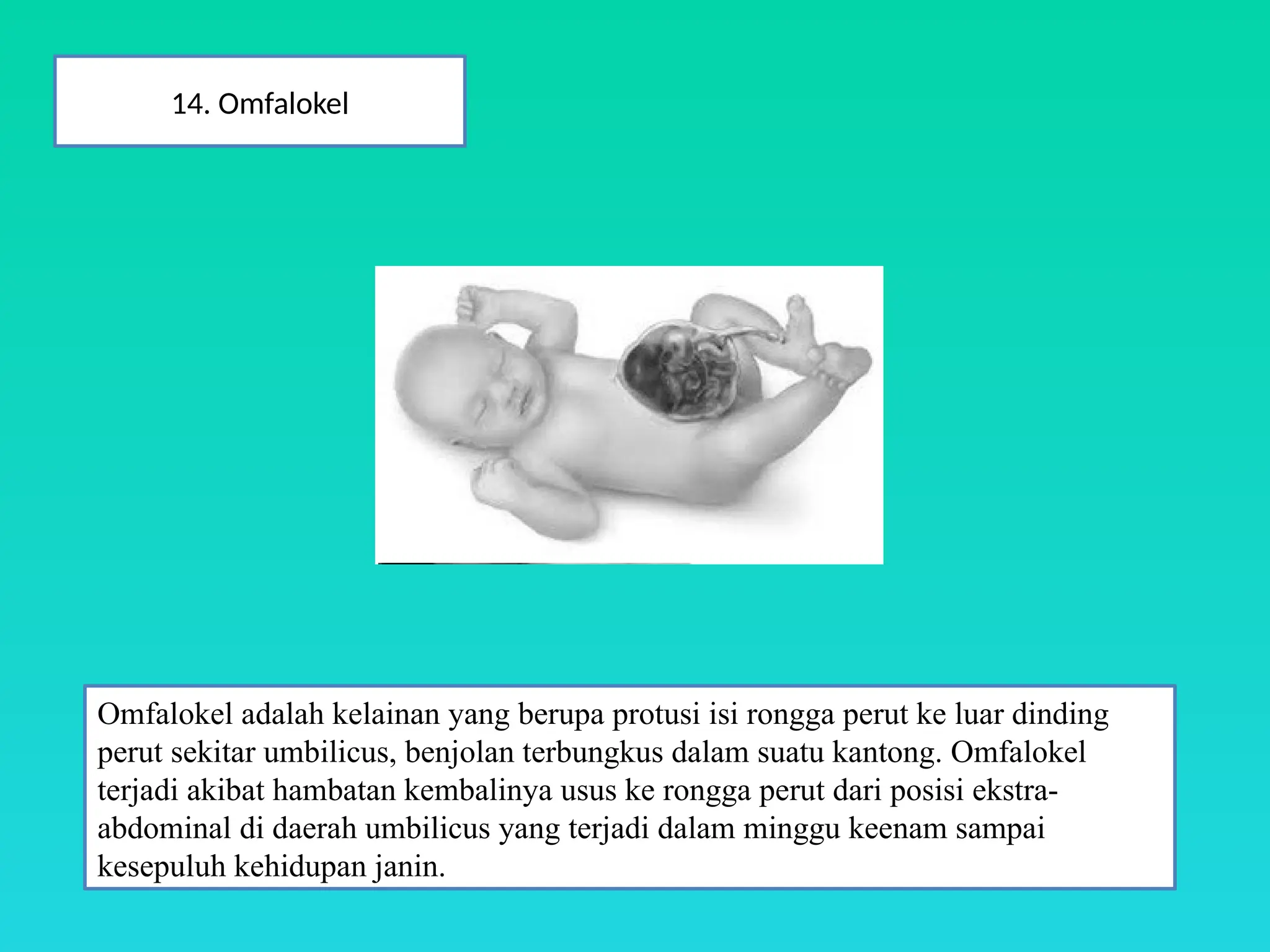 ppt kelainan..................,,.....pptx