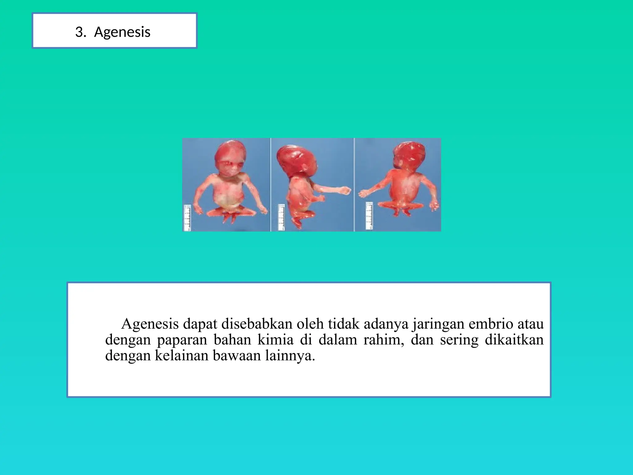 ppt kelainan..................,,.....pptx