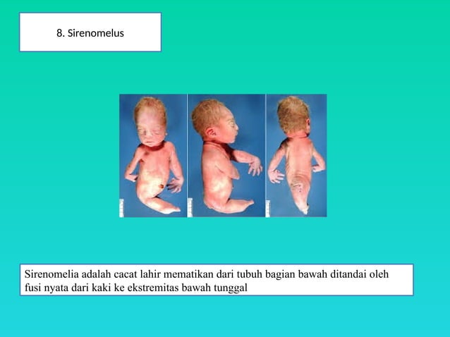 ppt kelainan..................,,.....pptx