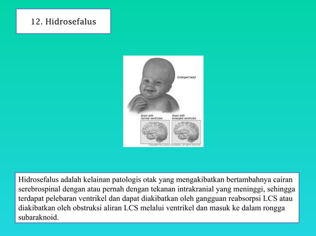 ppt kelainan..................,,.....pptx