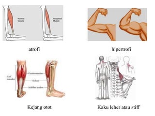 Ppt kelainan alat gerak dan teknologi | PPTX