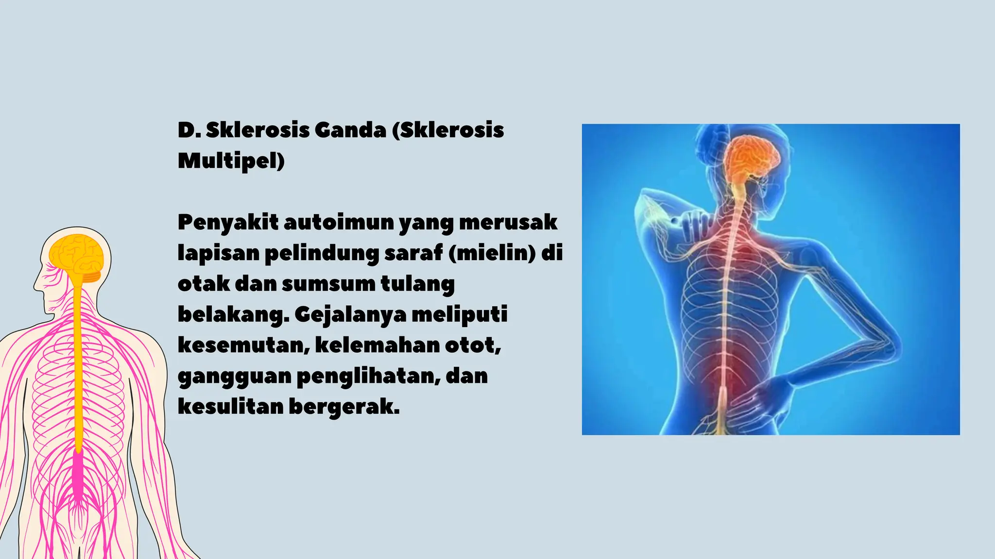 PPT Kelompok 3 Sistem Saraf.,,,,,,,,,,pdf | PDF