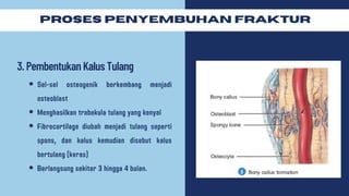 Sistem Skeletal | PDF
