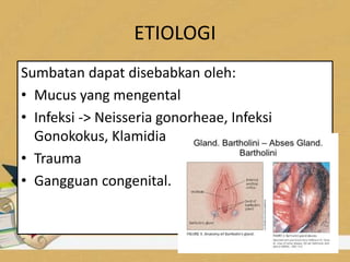 Kista Bartholini | PPTX
