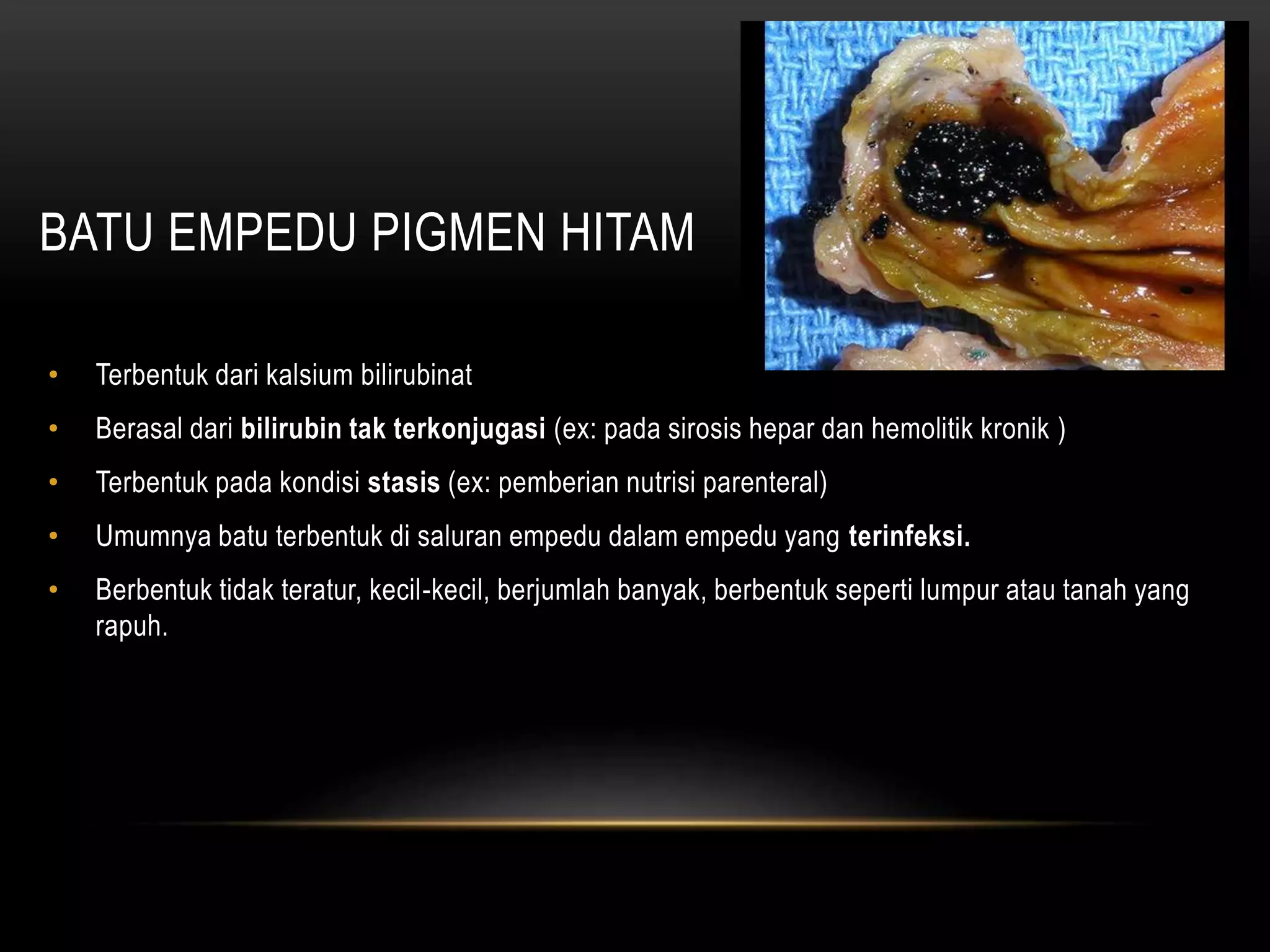 PPT KOLELITIASIS.ppt