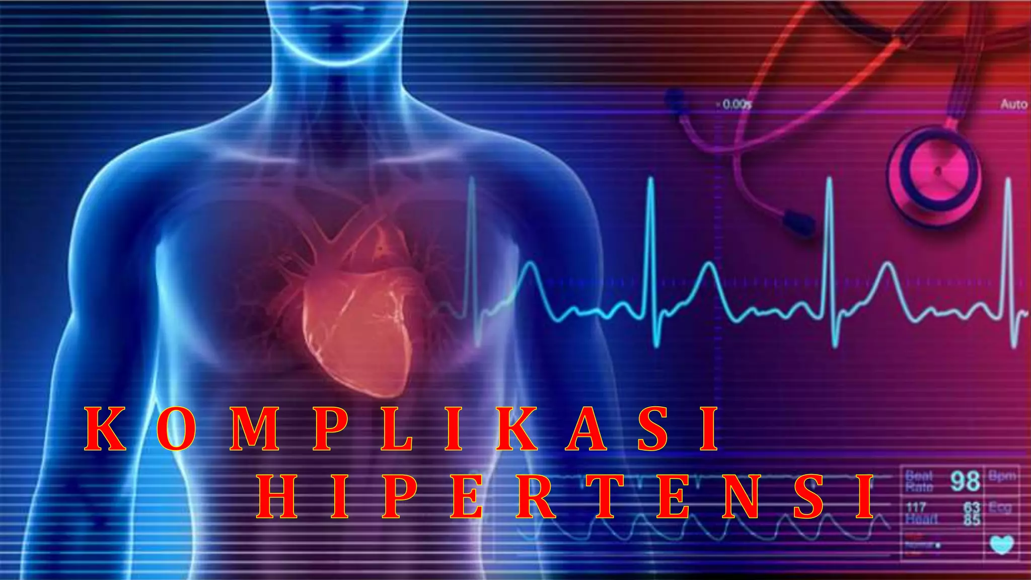 PPT KOMPLIKASI HIPERTENSI.pptx