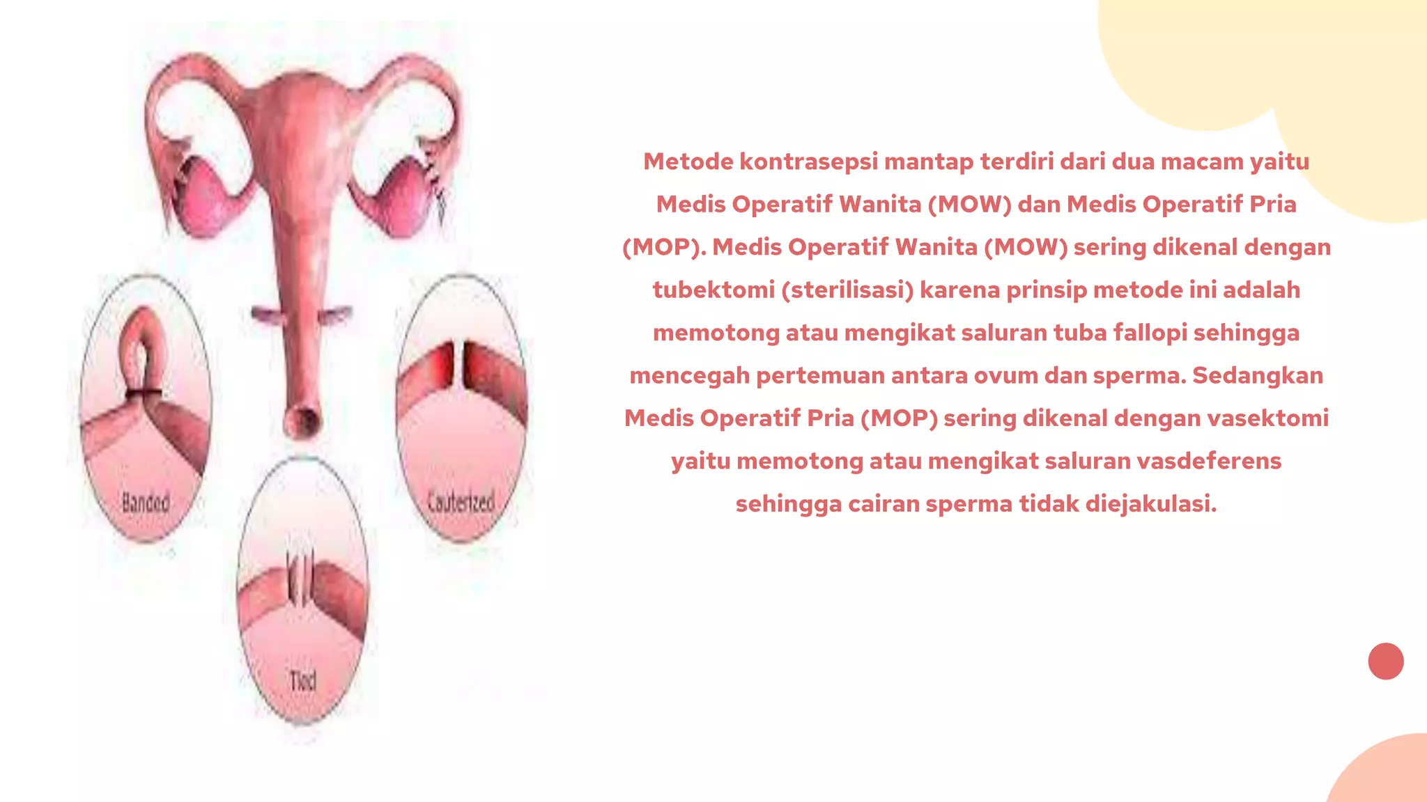 Ppt konseling mow | PPTX