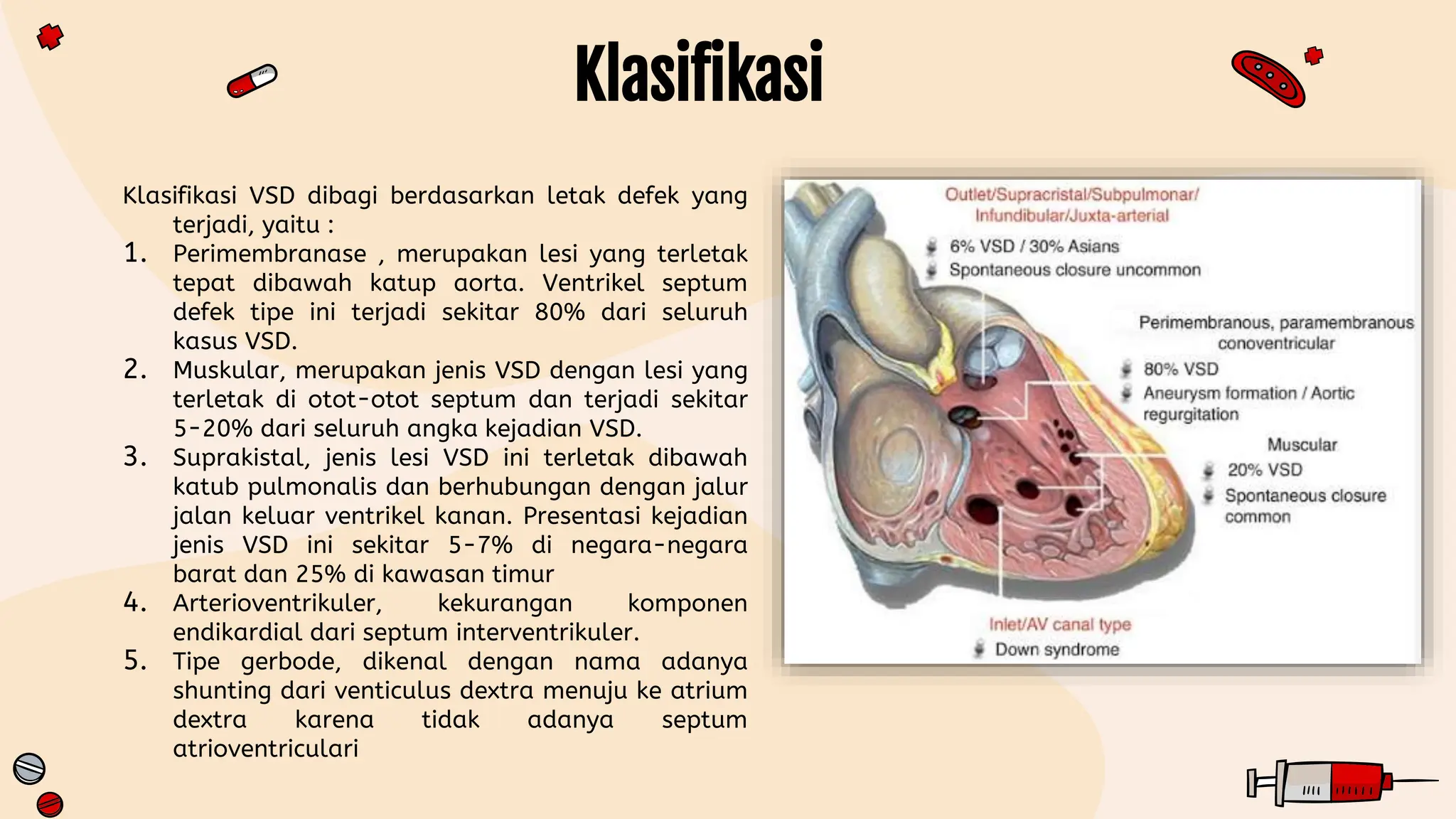 PPT PENYAKIT JANTUNG BAWAAN PADA ANAK.pptx
