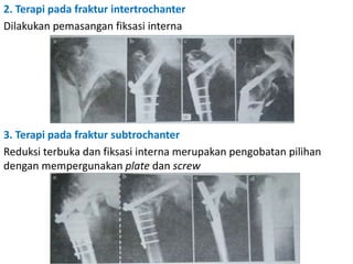 Ppt kti | PPTX