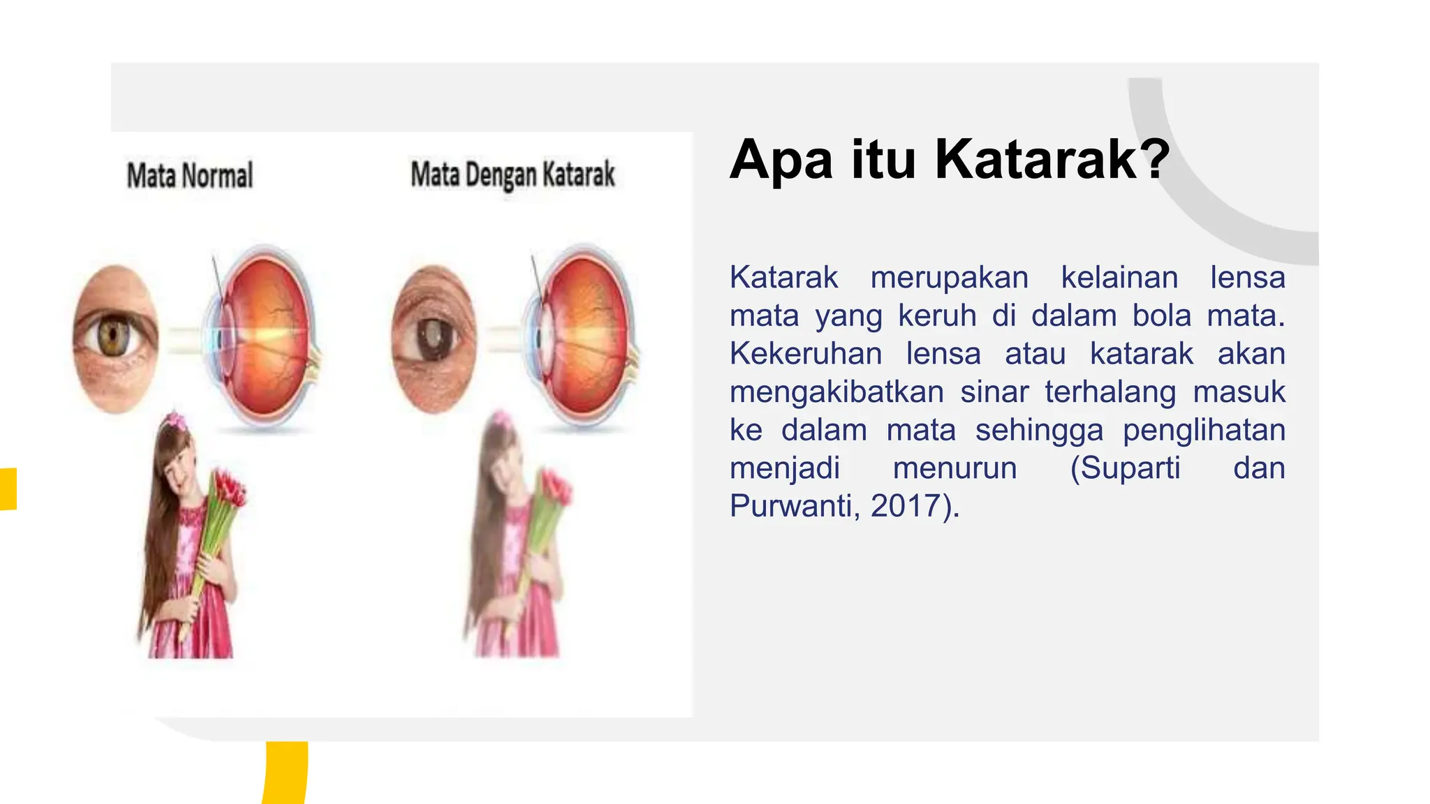 PPT kti jumiyati dengan masalah kesehatan katarak.pptx