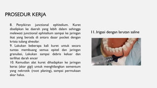 KURETASE.pptx