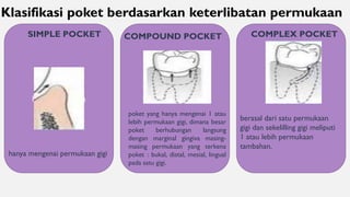 KURETASE.pptx