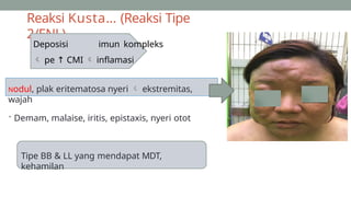 ppt tatalaksana kusta yang terbaru tahun | PPTX