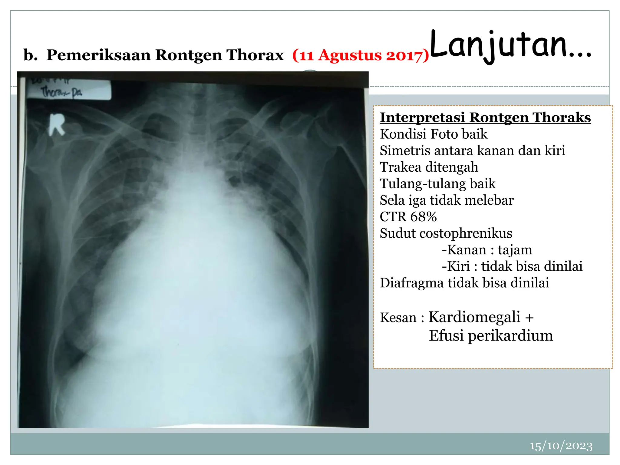 Laporan Kasus IPD.pptx