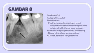 PPT LAPORAN INTERPRETASI RADIOLOGI SKILLS LAB 2 (029-034).pptx