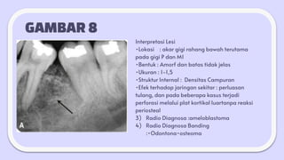 PPT LAPORAN INTERPRETASI RADIOLOGI SKILLS LAB 2 (029-034).pptx