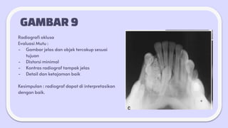 PPT LAPORAN INTERPRETASI RADIOLOGI SKILLS LAB 2 (029-034).pptx