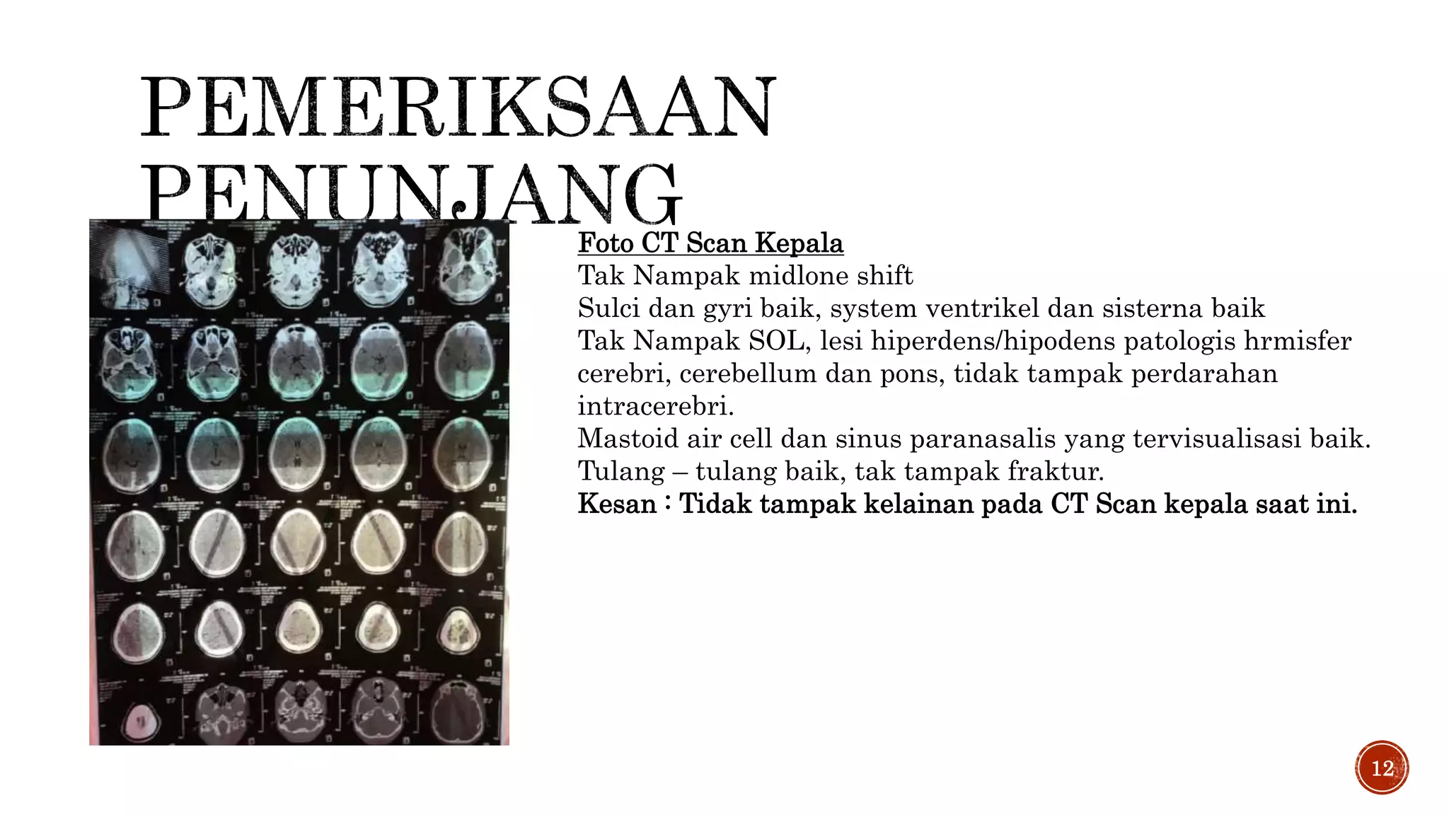 (PPT) Laporan Kasus Poli Epilepsi.pptx