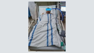 PPT LAPORAN KASUS TERAPI INTENSIF PADA STROKE.pptx