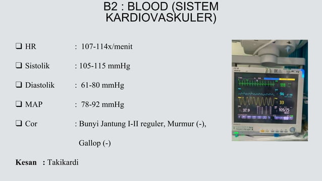 PPT LAPORAN KASUS TERAPI INTENSIF PADA STROKE.pptx