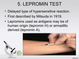 Mycobacterium leprae - Lab diagnosis | PPT