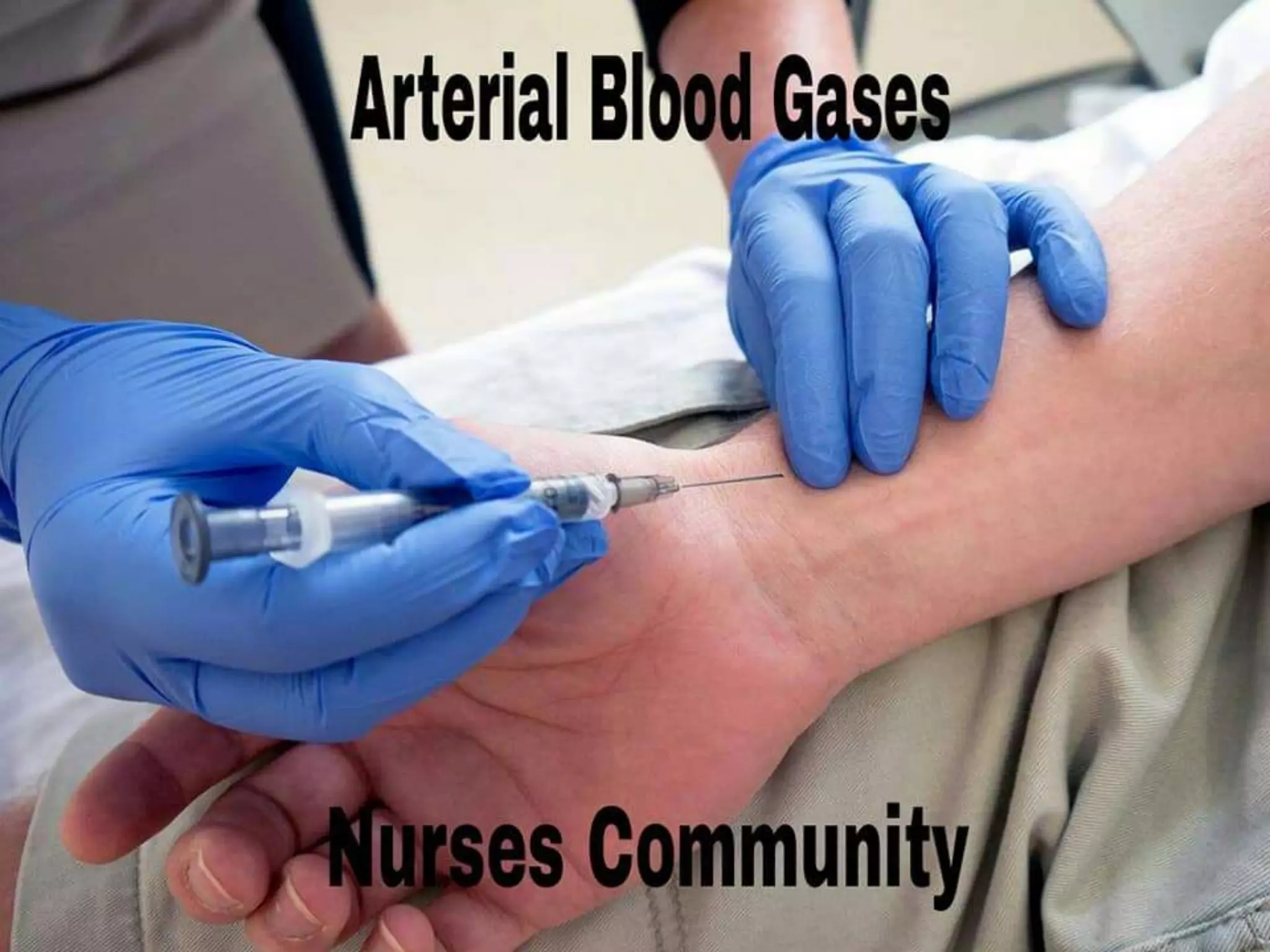 Arterial Blood Gas Analysis | PPTX
