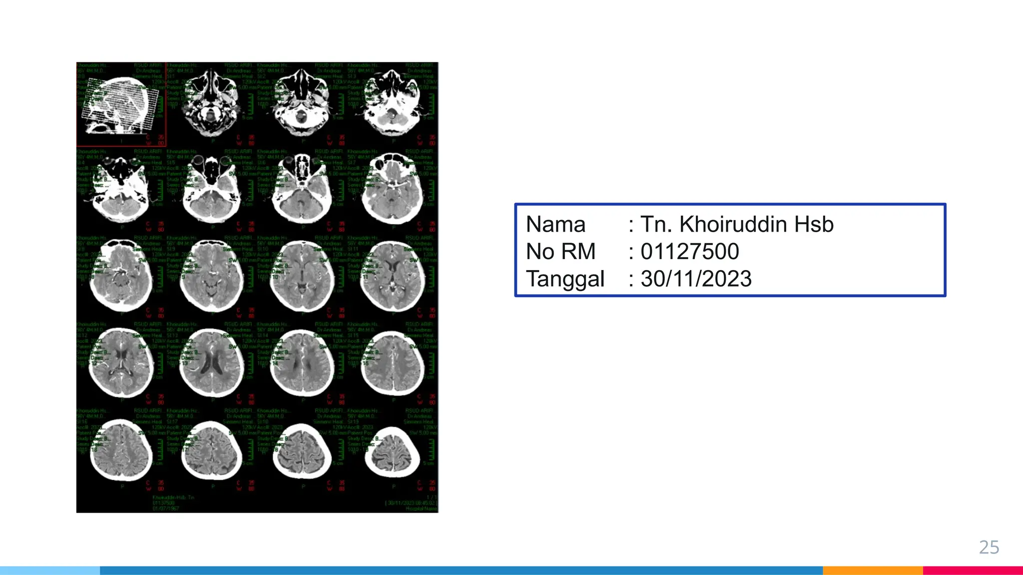 Ppt Radiologi normal dan abnormal-ahp.pptx