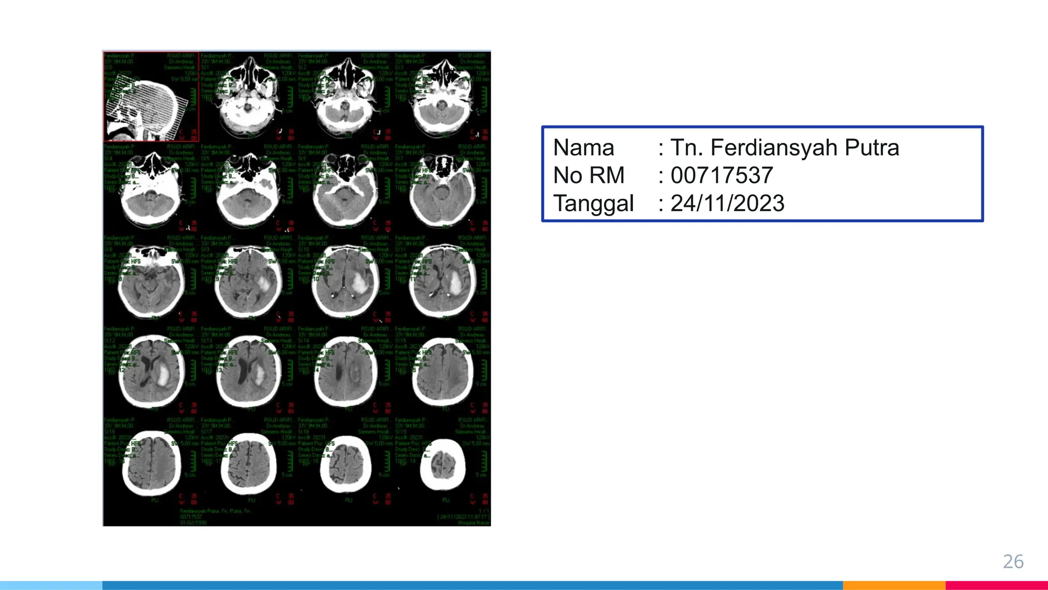 Ppt Radiologi normal dan abnormal-ahp.pptx