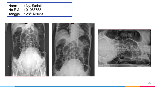 Ppt Radiologi normal dan abnormal-ahp.pptx