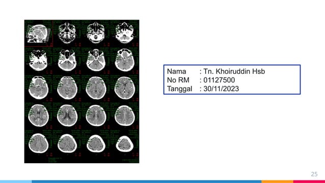 Ppt Radiologi normal dan abnormal-ahp.pptx