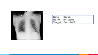 Ppt Radiologi normal dan abnormal-ahp.pptx