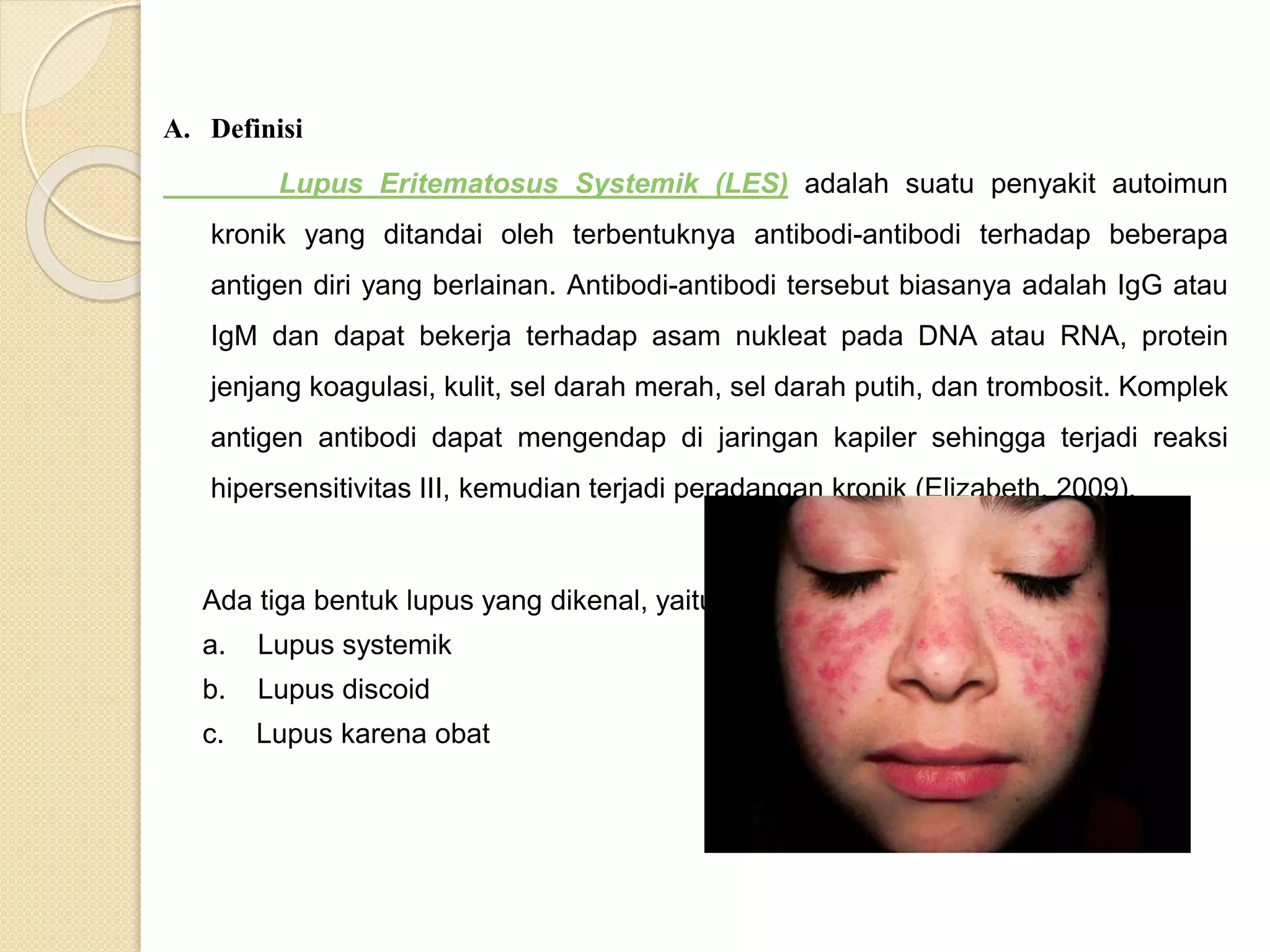 PPT lupus eritematosus systemic | PPTX