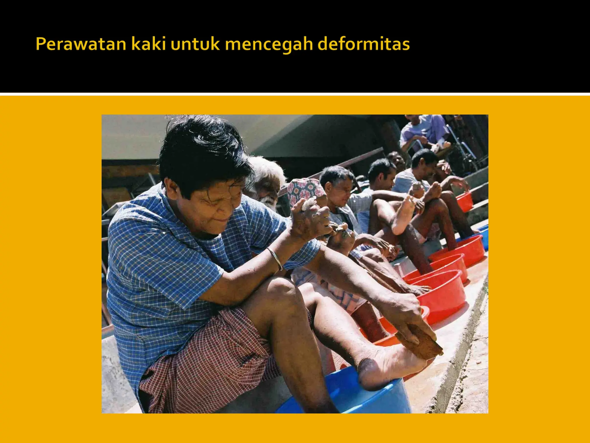 POWERPOINT MATERI MATERI KUSTA (LEPRA).ppt