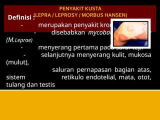POWERPOINT MATERI MATERI KUSTA (LEPRA).ppt