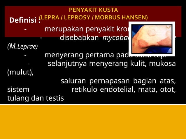 POWERPOINT MATERI MATERI KUSTA (LEPRA).ppt