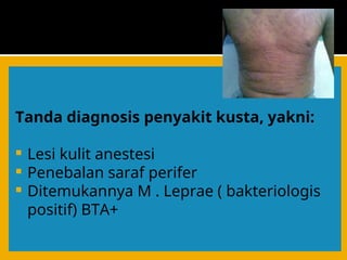 POWERPOINT MATERI MATERI KUSTA (LEPRA).ppt
