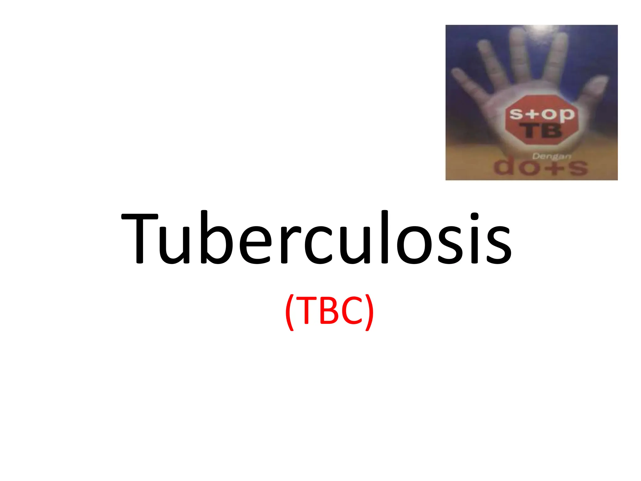 Ppt materi tuberculosis paru fixed. pptx | PPTX