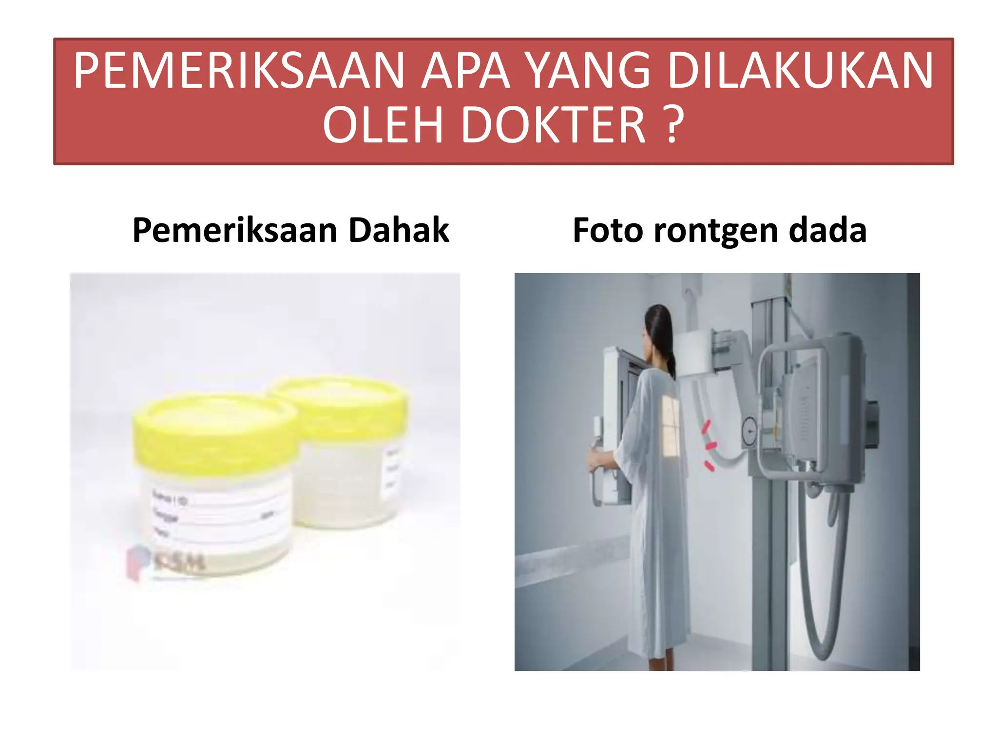 Ppt Materi Tuberculosis Paru Fixed Pptx Pptx