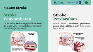 PPT Materi WSD 2025 gejala stroke , tanda bahaya stroke dan cara ...