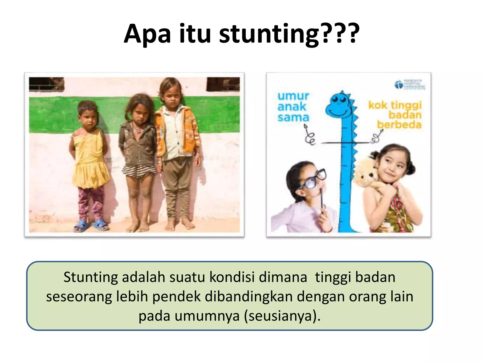 Microteaching CPNS_Stunting | PPT