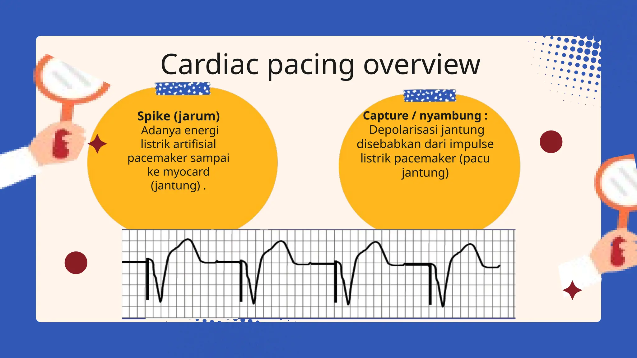 Pengenalan Penggunaan temporary pacemaker dasa.pptx