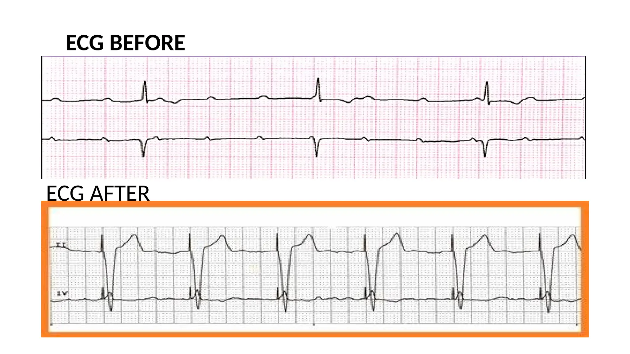 Pengenalan Penggunaan temporary pacemaker dasa.pptx