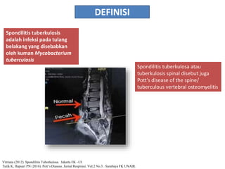 PPT_MINGGU 7_MAYA_BEDAH ORTHOPEDI_ SPONDILITIS TB.pptx