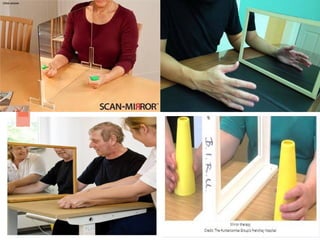 ppt mirror terapi pada pasien stroke terapi | PPT