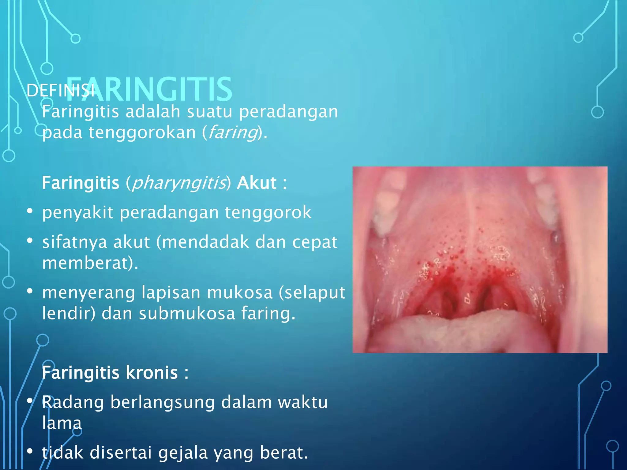 PPT MK PATOFISIOLOGI ISPA.ppt
