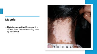 Clinical assessment in Dermatology ( Morphology ) | PPTX