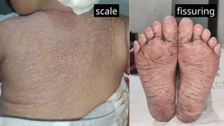 Clinical assessment in Dermatology ( Morphology ) | PPTX